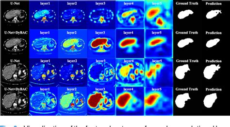 Figure 3 From Semi Supervised Medical Image Segmentation Using Adversarial Consistency Learning