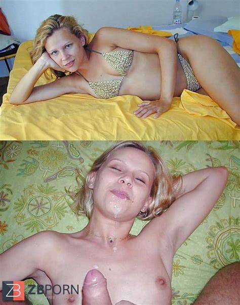 Just Before And After Facials Zb Porn
