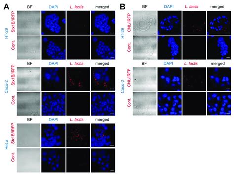 Representative Confocal Microscopy Images Showing Binding Of Shiga