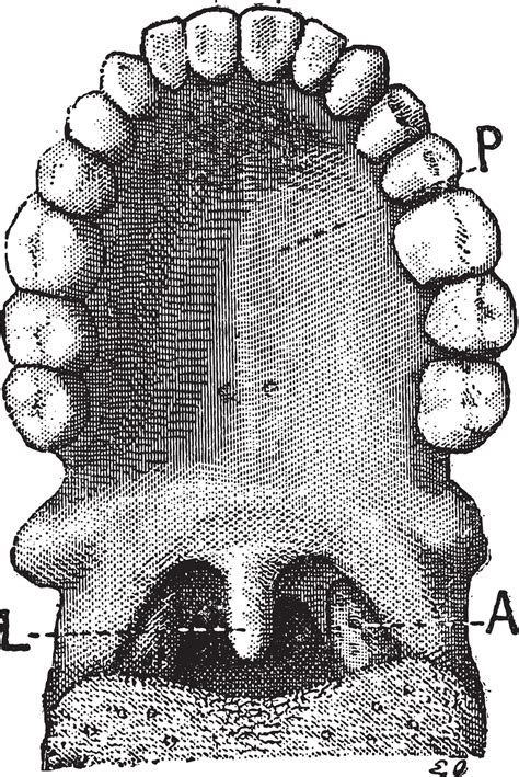 The Palatine Uvula Or Uvula Vintage Engraving 35466700 Vector Art At