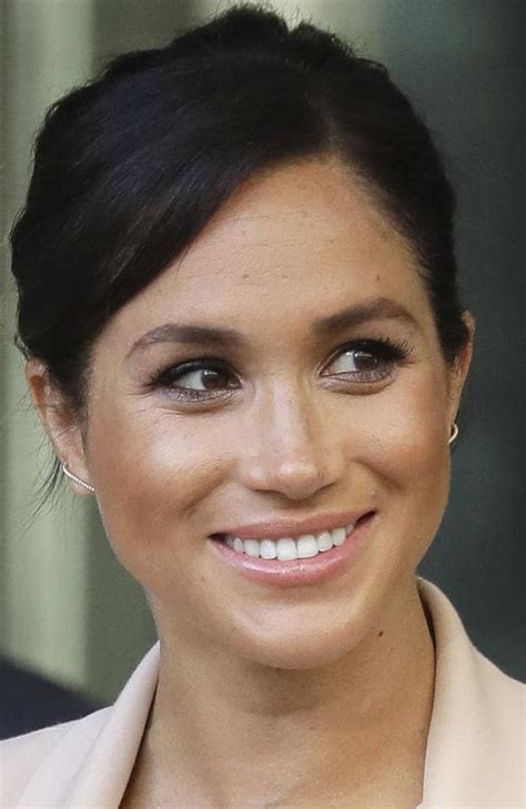 Meghan Markle Women Request Nose Freckle Treatment To Look Like Royal
