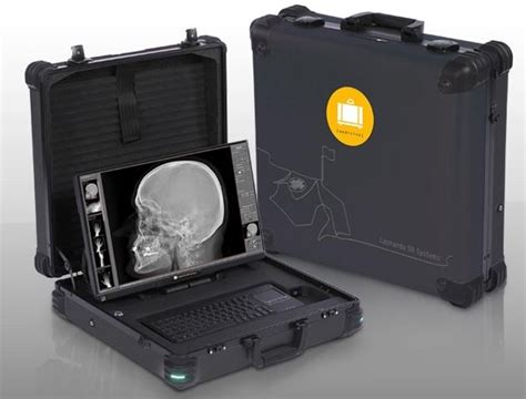 X Ray Case Leonardo Dr Mini Iii • Healthcare In
