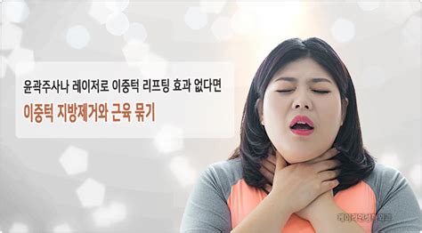 윤곽주사나 레이저로 이중턱 리프팅 효과 없다면 이중턱 지방제거 케이라인 자주묻는질문