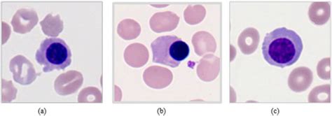 Deep Learning For Extremity Radiographs Confounded By Labels Artofit