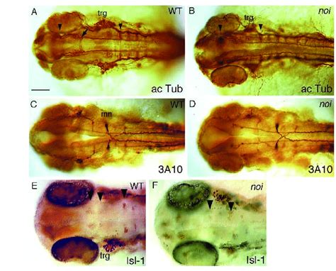 Overall Organisation Of The Cns In Noi Mutant Embryos Shown Are Dorsal