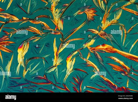 Edta Crystals Polarised Light Micrograph Of A Section Through