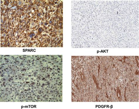 Immunohistochemistry And Morphoproteomic Studies Sparc Secreted