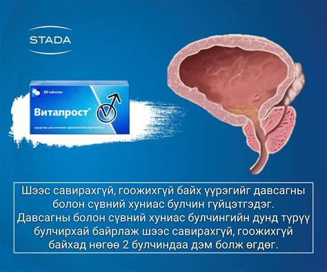 📍Түрүү булчирхайн бага аарцгийн Stada Cis Mongolia