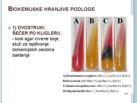 Nastavna Tema Bakterioloke Hranjive Podloge Predmet Mikrobiologija Smjer