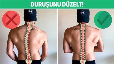 Skolyoz Omurga E Rili I Etkili Egzersiz Duru Unu D Zelt