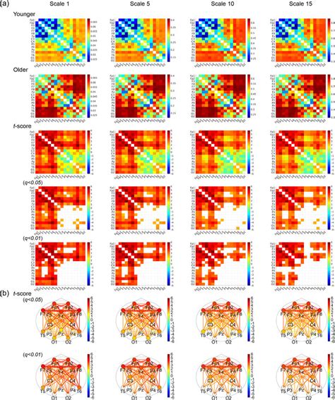 A Mean Values Of Sample Entropy Sampen In The Younger Group Upper