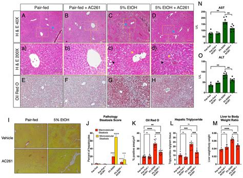 Treatment With AC261066 AC261 Mitigates Hepatic Steatosis And