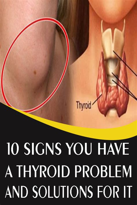10 Signs You Have A Thyroid Problem And Solutions For It