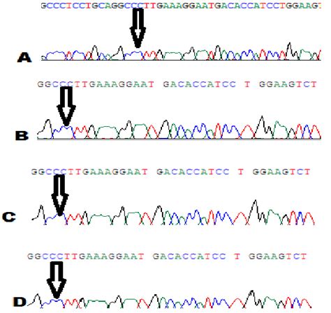 Analysis Of Sequencing Electropherograms From Exon 11 Arrows Indicate Download Scientific