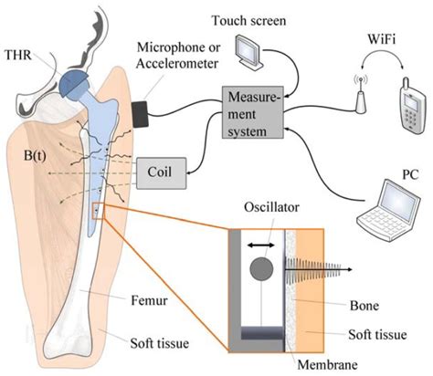 Schematic Illustration Of The Passive Sensor Array Inside A Total Hip
