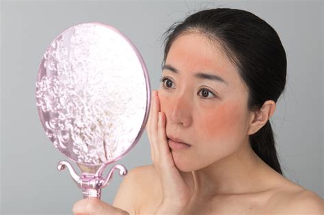 夏に日焼けしてしまった肌をいち早く戻すケア方法