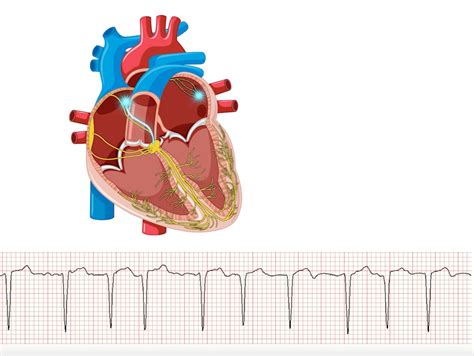 Atrial Fibrillation Why Awareness And Treatment Now Will Save Your
