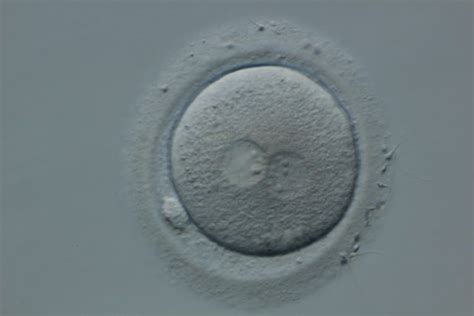 View From The ORM Fertility Embryology Laboratory Fertility Road