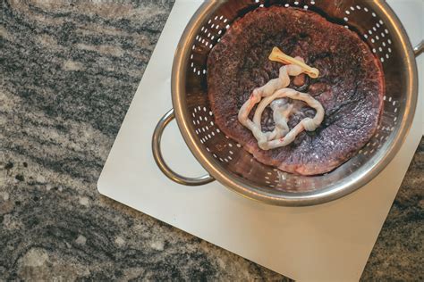 Encapsulation In Action Tree Of Life Placenta