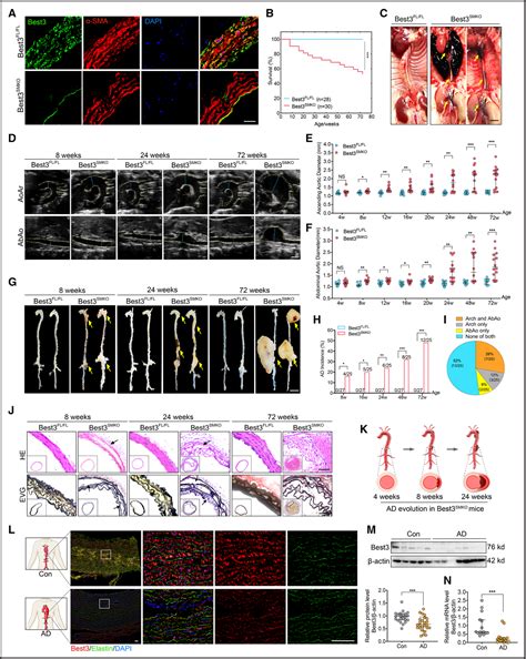 Figure 1 From Bestrophin3 Deficiency In Vascular Smooth Muscle Cells