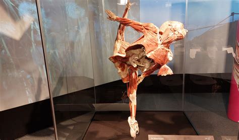 Anatómiai Múzeum Museum Menschlicher Körper Emxe