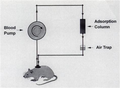Schematic Representation Of Extracorporeal Immunoadsorption Of Whole