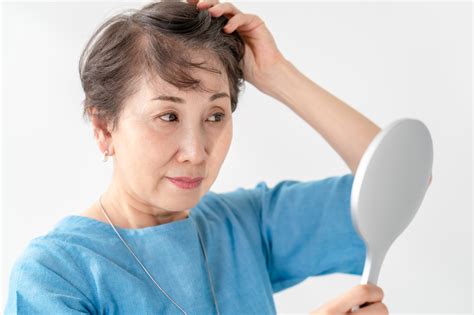神戸市兵庫区でaga・faga薄毛でお悩みの方はでぐちクリニックへ