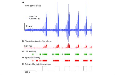Simple And Fast Unsupervised Seizure Detection Method A The Raw Download Scientific