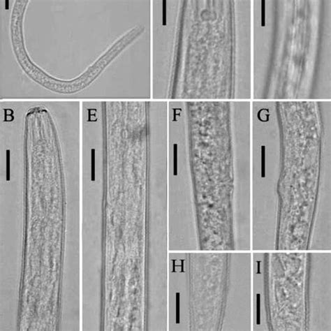 Light Microphotographs Of Pratylenchus Thornei Sher And Allen 1953 Download Scientific Diagram
