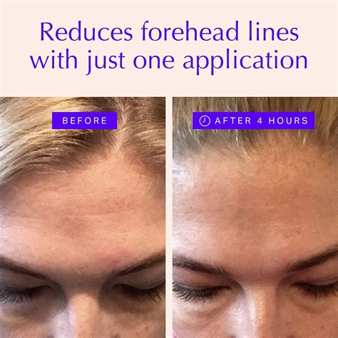 Forehead And Eye Wrinkle Patches Overnight Anti Wrinkle Treatment Reduce Fine Lines And Frown