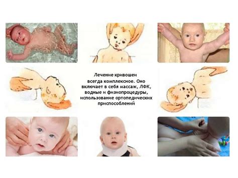 Медицинская и психосоциальная реабилитация при болезнях у детей в