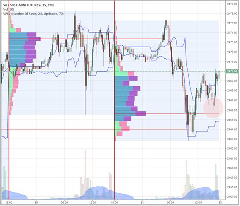 How To Place A Stop Loss Order Properly Why Yours Always Get Hit