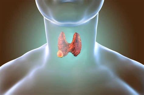 Parathyroid Disorders Nayana Tara Vasireddy