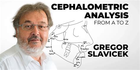 Cephalometric Analysis From A To Z Everything A Dentist Should Know