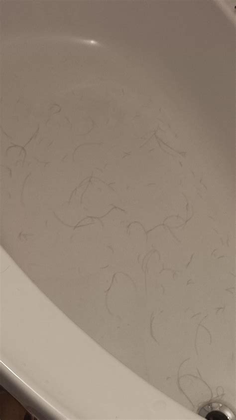 Sudden Hair Loss Rmedicaladvice