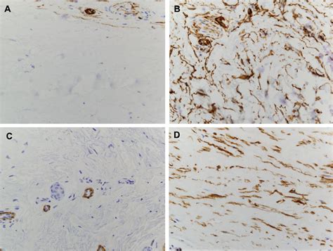 Response To ‘correspondence On ‘machine Learning Integration Of Scleroderma Histology And Gene