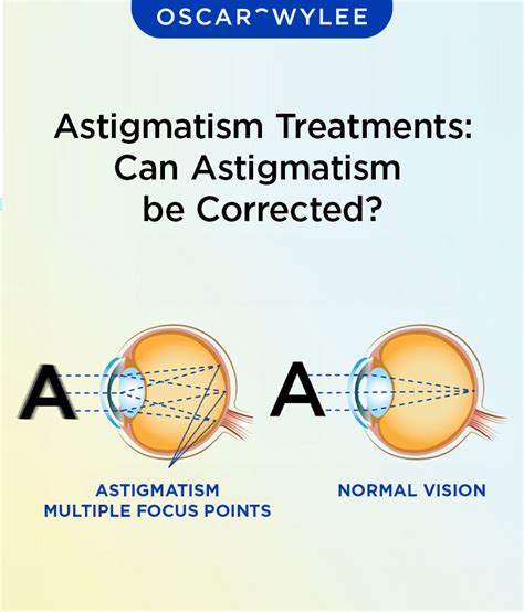 Astigmatism Treatments Can Astigmatism Be Corrected