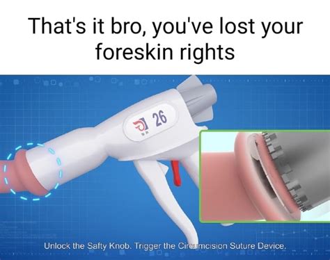 Thats It Bro Youve Lost Your Foreskin Rights Unlock The Safty Knob