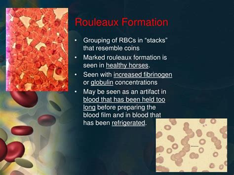 Ppt Hematology Powerpoint Presentation Free Download Id3074089