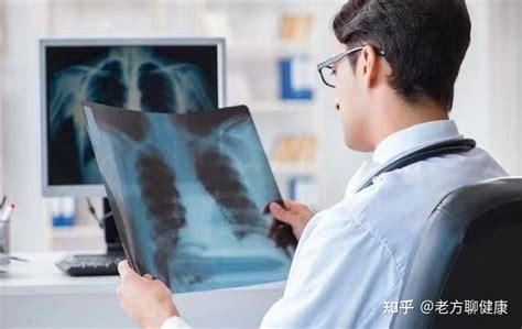 为何近年来有肺结节的人越来越多？和疫苗有关吗？医生说出实情 知乎