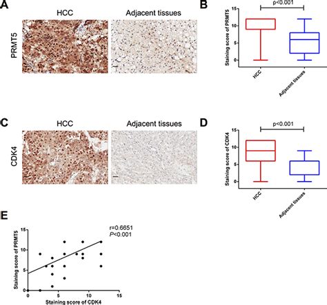 Prmt5 Competitively Binds To Cdk4 To Promote G1 S Transition Upon