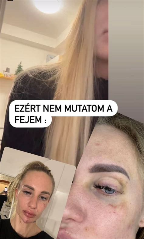VV Virág botrányos verekedéséről újabb részletek derültek ki ORIGO