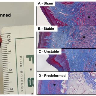 Mesh Vagina Complex Explants Download Scientific Diagram