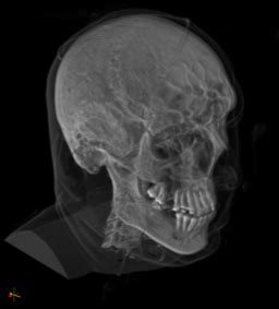 Packages ITK Wasm Documentation