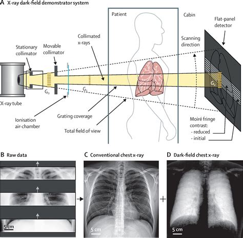 drawing of an x ray tube and collimator schematic