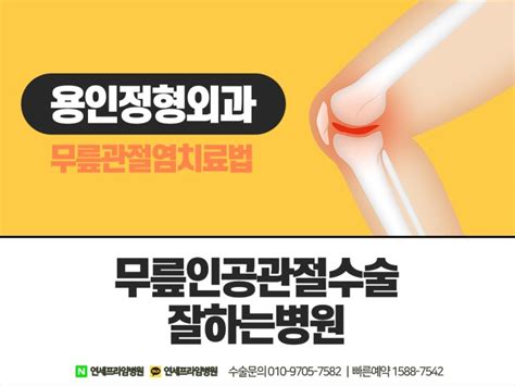 무릎인공관절수술잘하는곳 무릎관절염치료법 역시 용인정형외과 병원 네이버 블로그