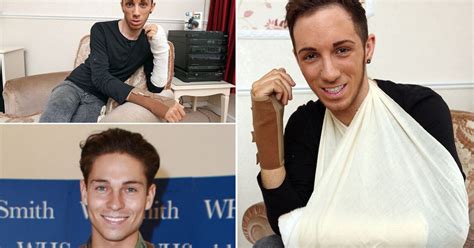 Joey Essex Lookalike Breaks Both Hands After Drink Is Spiked On Night