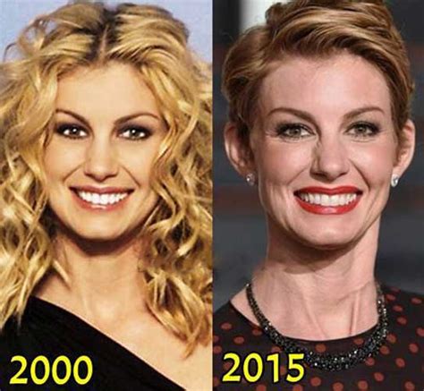 Faith Hill Plastic Surgery Botox Eyebrow Surgery Lip Filler
