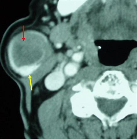 Figure 1 From Pictorial Review Of The Imaging Anatomy And Common