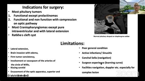 Neurosurgical Tv Global Series 10 Endoscopic Transphenoid Management